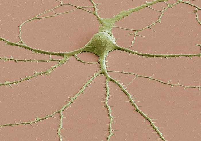 Portraits of the Mind: Brain Cells Under Microscope | Amusing Planet